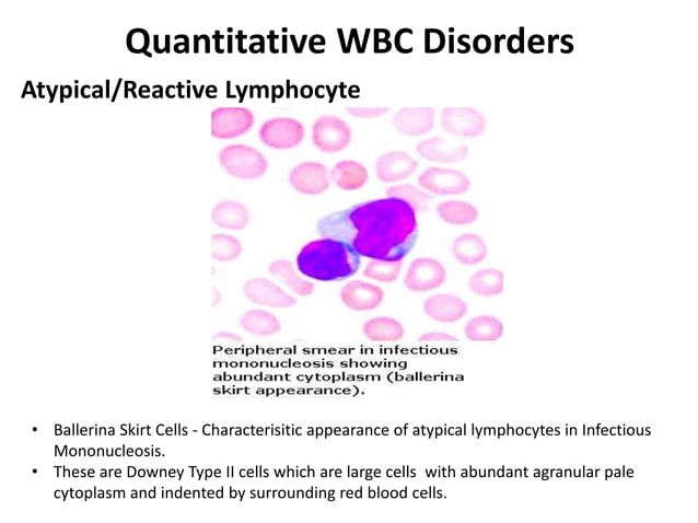 Benign White blood cell (WBC) Disorders | PPTX