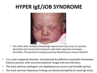 Benign White blood cell (WBC) Disorders | PPTX