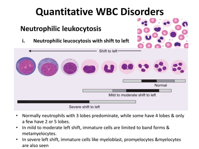 Benign White blood cell (WBC) Disorders | PPTX