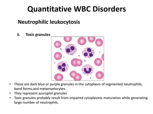 Benign White blood cell (WBC) Disorders | PPTX