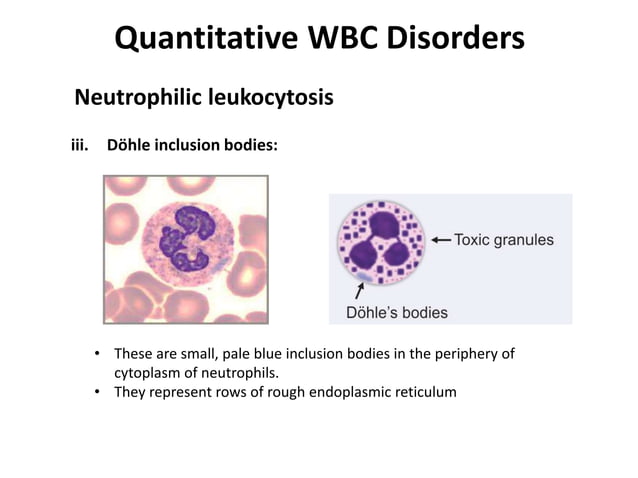 Benign White blood cell (WBC) Disorders | PPTX