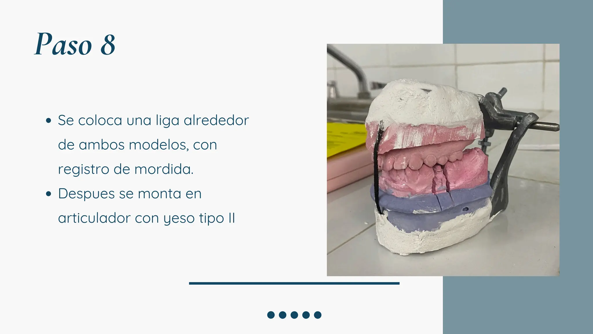 Procedimiento paso a paso del troquelado dental | PDF