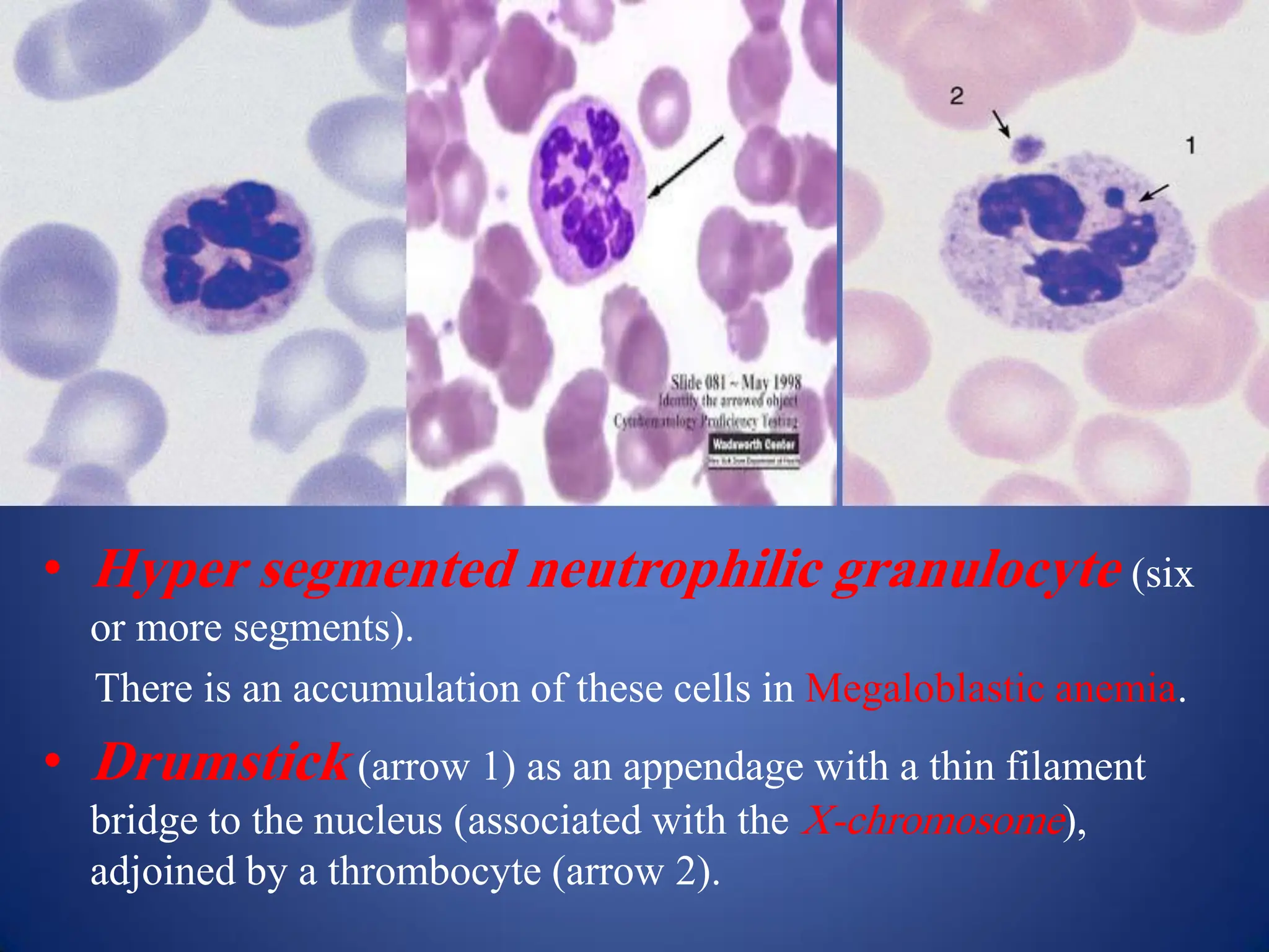 White Cell Precursors.pdf