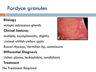 White diseases of the oral mucosa in oral medicine | PPTX