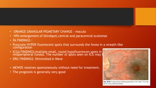 White dot syndrome | PPTX