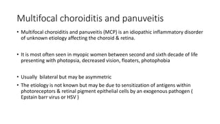 White dot syndromes | PPTX