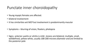 White dot syndromes | PPTX