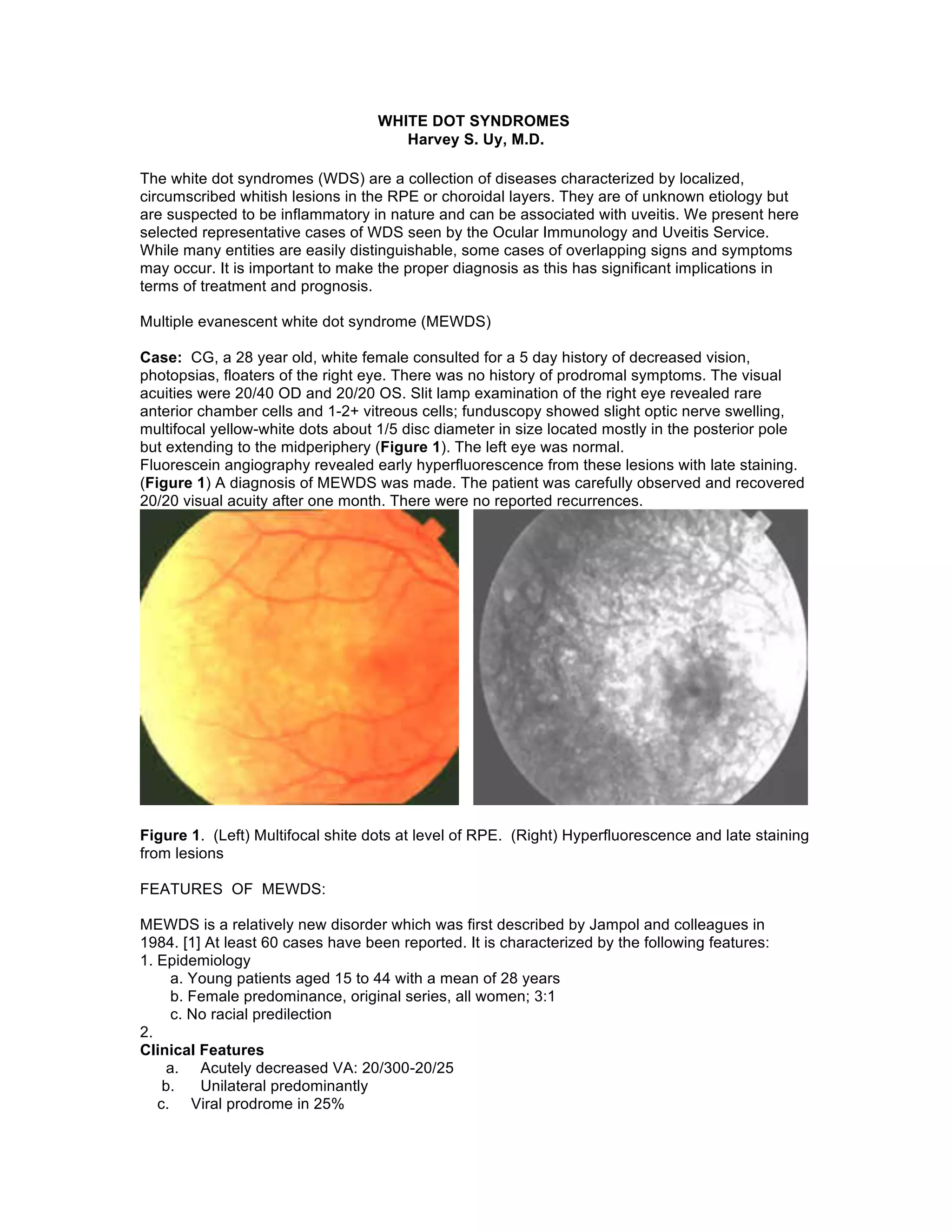 white_dot_syndromes.pdf