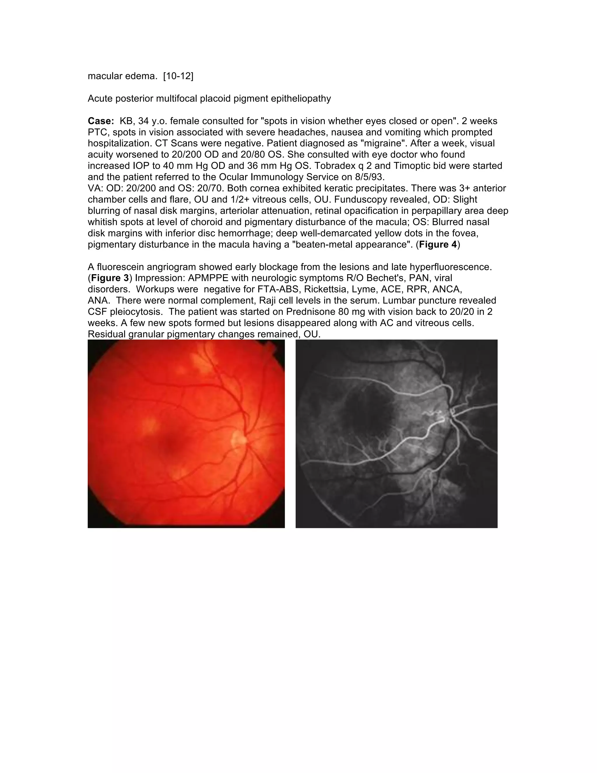 white_dot_syndromes.pdf