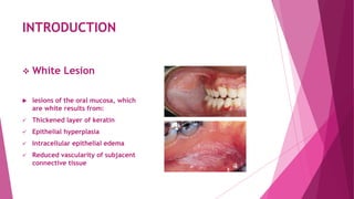 White lesion in oral cavity | PPTX