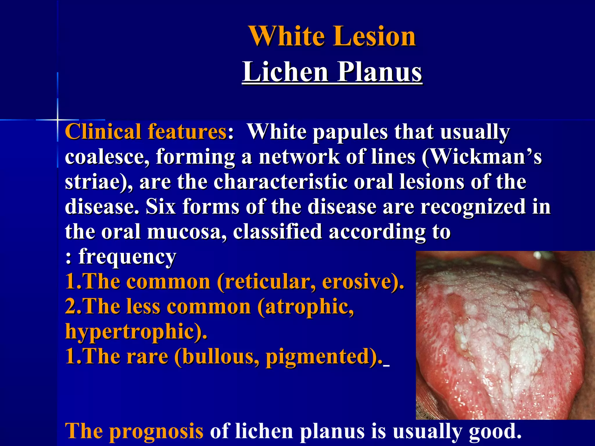 White lesions | PPT