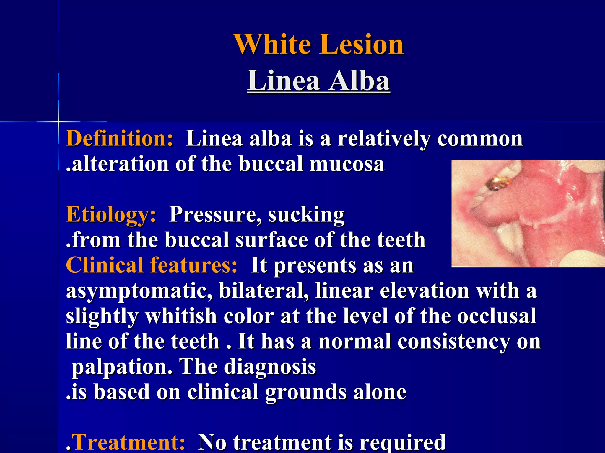 White lesions | PPT