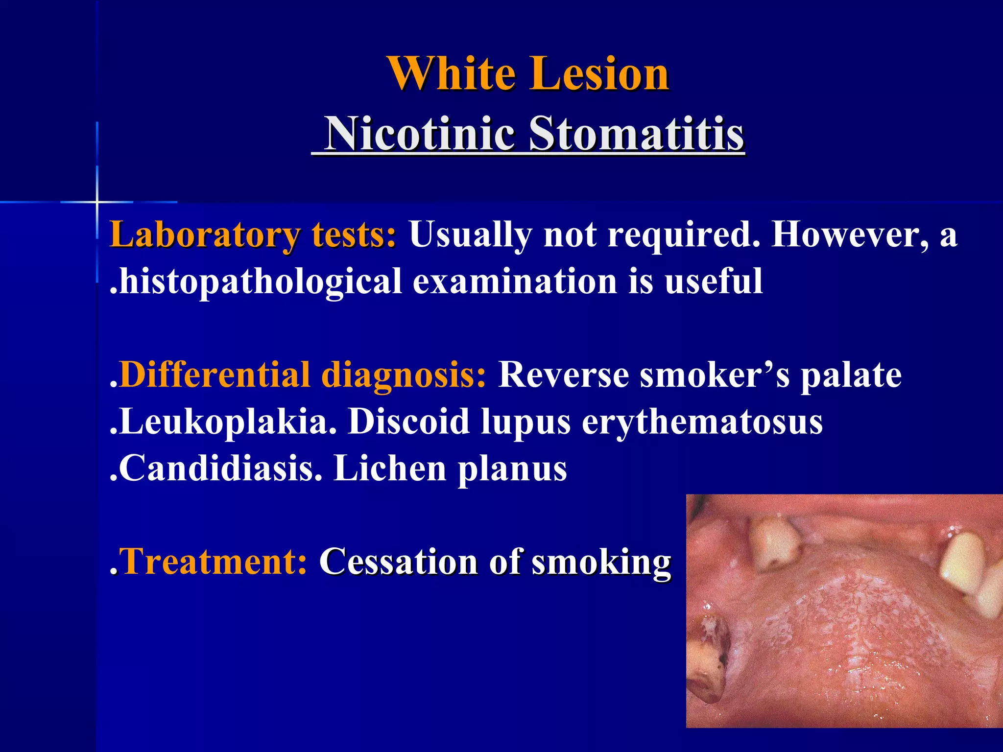 White lesions | PPT