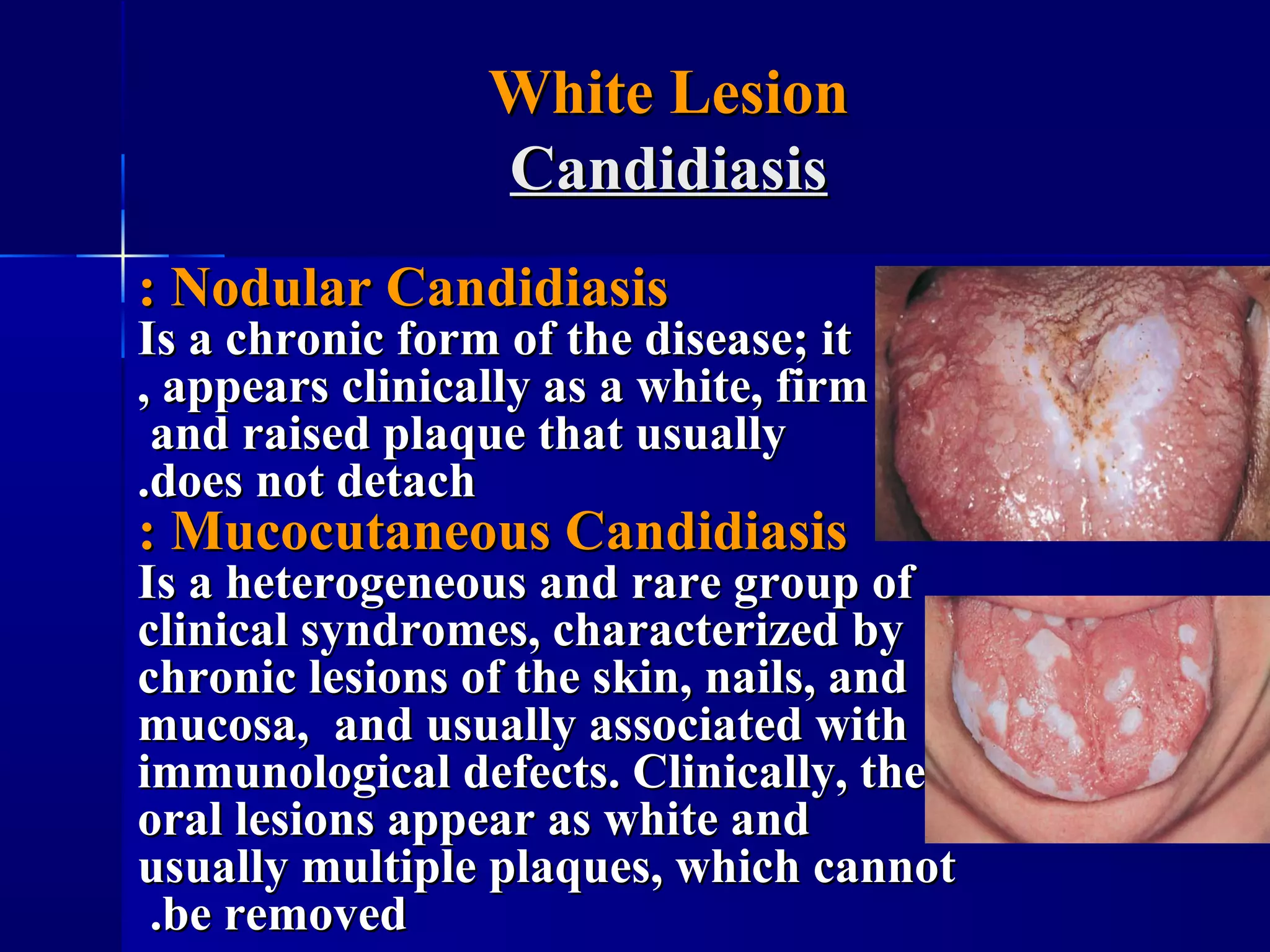 White lesions | PPT