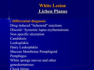 White lesions | PPT