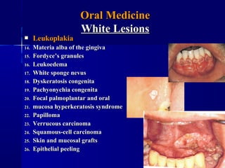 White lesions | PPT