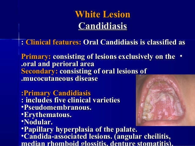 White lesions