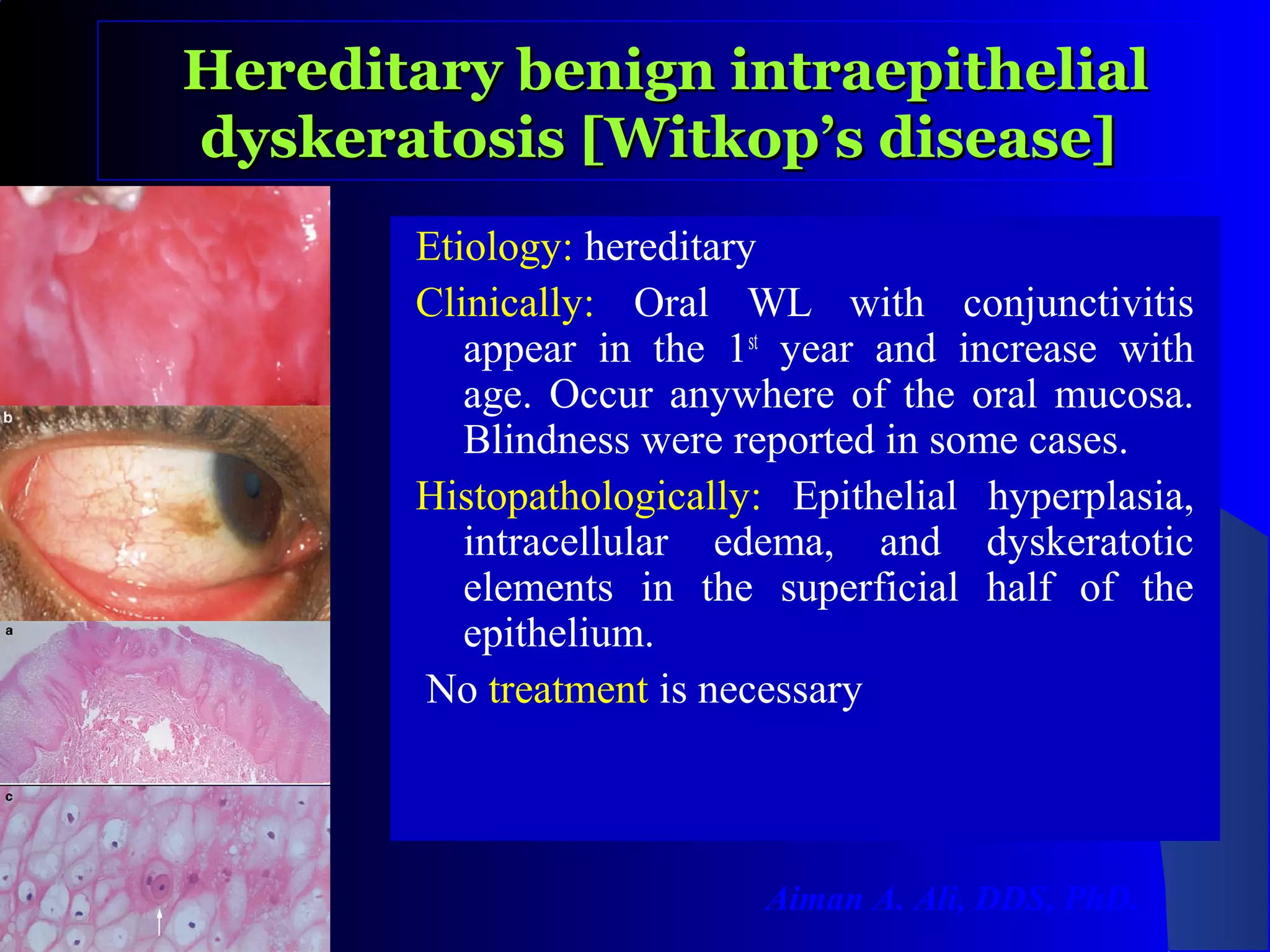 White lesions | PPT