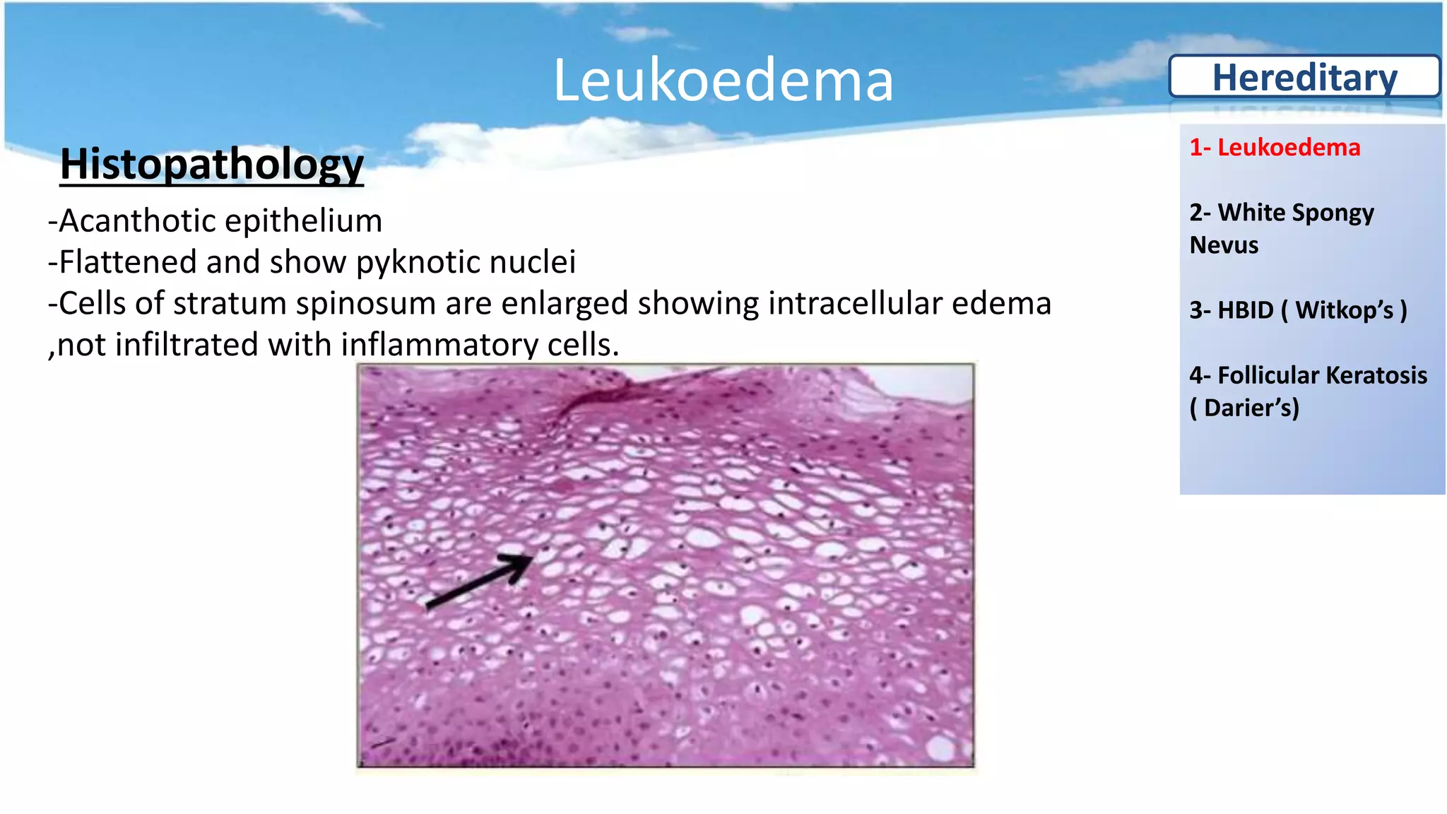 White Lesions of Oral Cavity - M. Abdelhamid | PPTX | Ear, Nose and ...