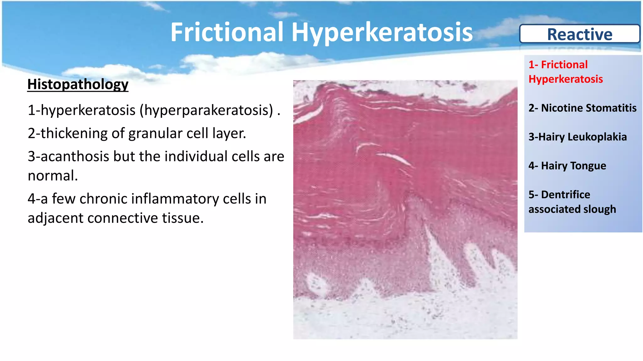 White Lesions of Oral Cavity - M. Abdelhamid | PPTX | Ear, Nose and ...