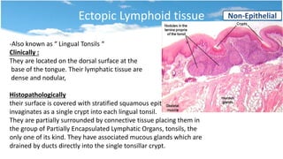 White Lesions of Oral Cavity - M. Abdelhamid | PPTX