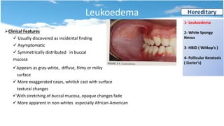 White Lesions of Oral Cavity - M. Abdelhamid | PPT