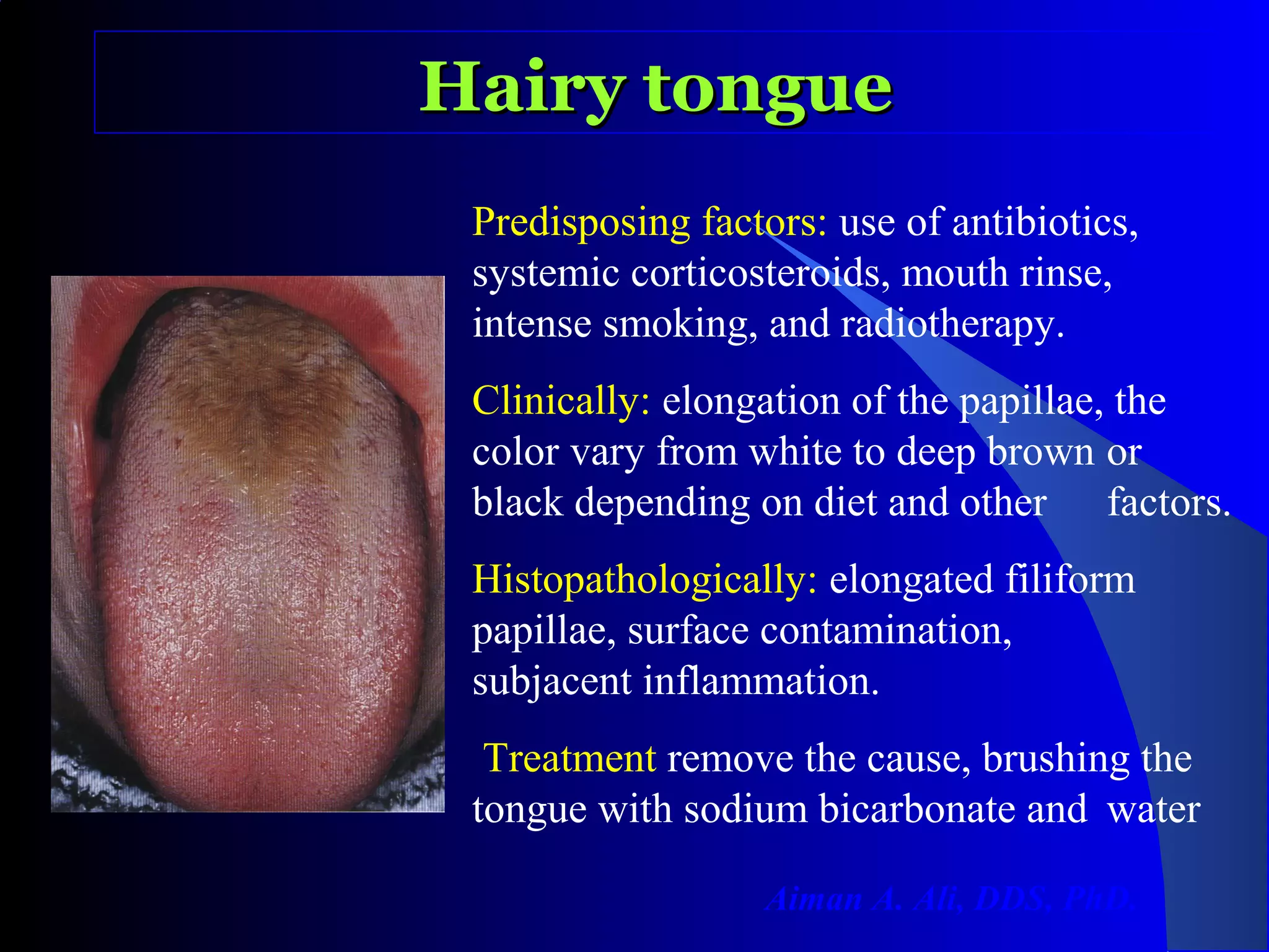 Oral White lesions | PPT