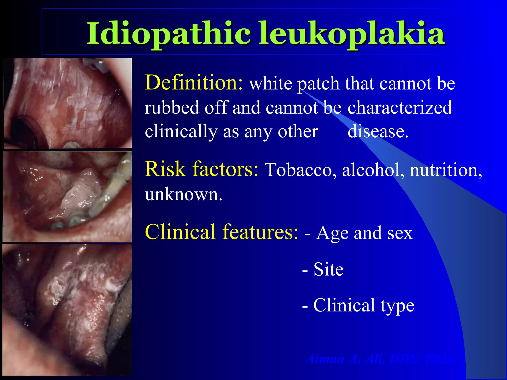 Oral White lesions | PPT