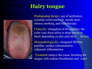 Filiform Papillae White