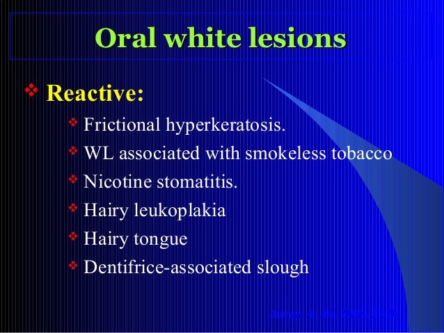 Oral Frictional Hyperkeratosis Tongue