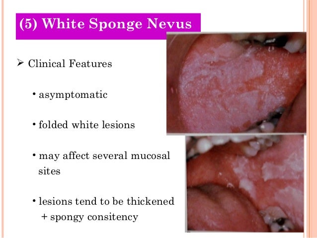 White lesions (2)