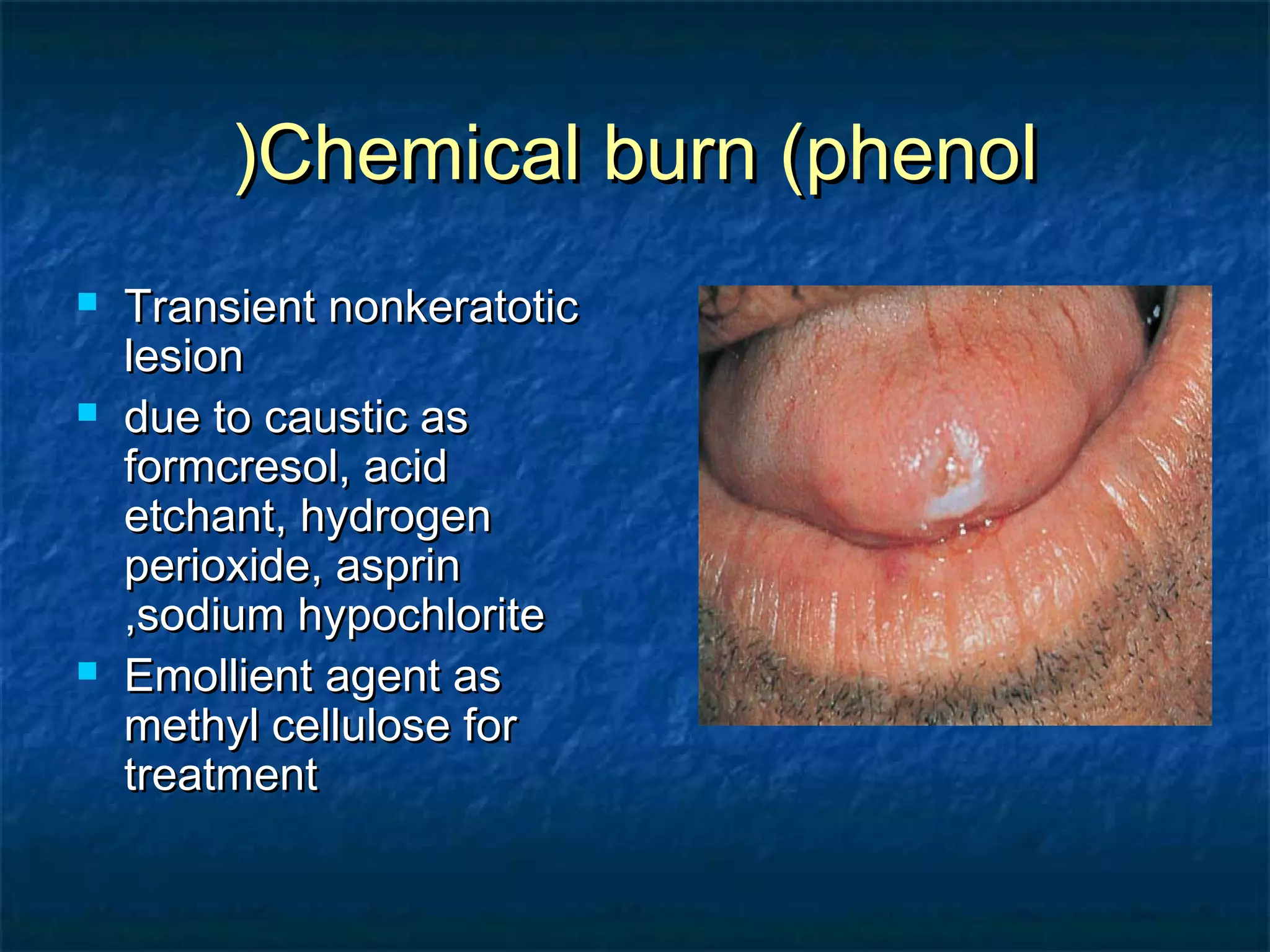 White lesions(collection) | PPT