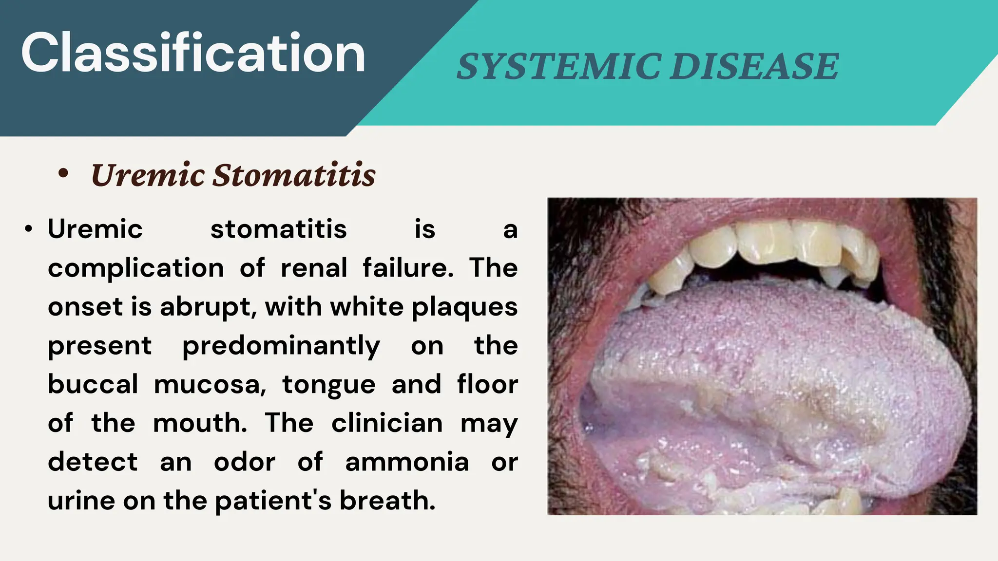 white lesions of oral mucosa........pptx