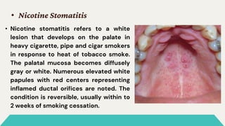 white lesions of oral mucosa........pptx