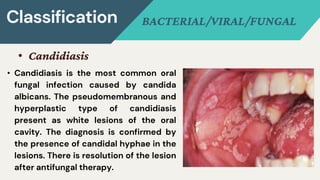 white lesions of oral mucosa........pptx