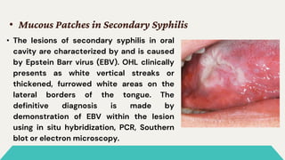 white lesions of oral mucosa........pptx