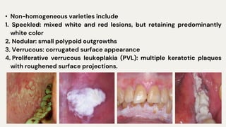 white lesions of oral mucosa........pptx