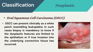 white lesions of oral mucosa........pptx