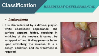 white lesions of oral mucosa........pptx