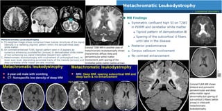 White matterds approach | PDF