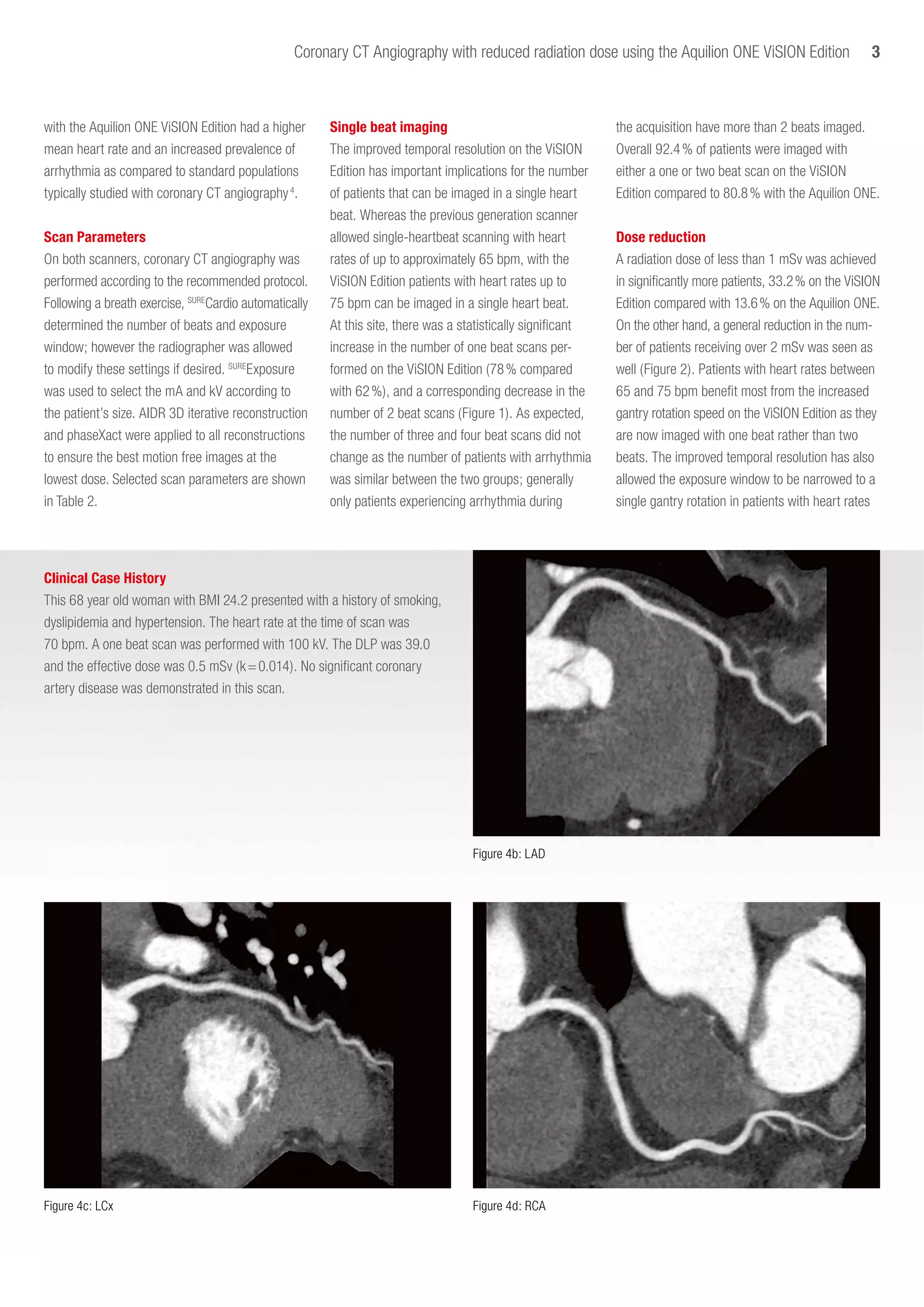 White paper "coronary ct angiography with reduced radiation dose using the aquilion one vi sion ...
