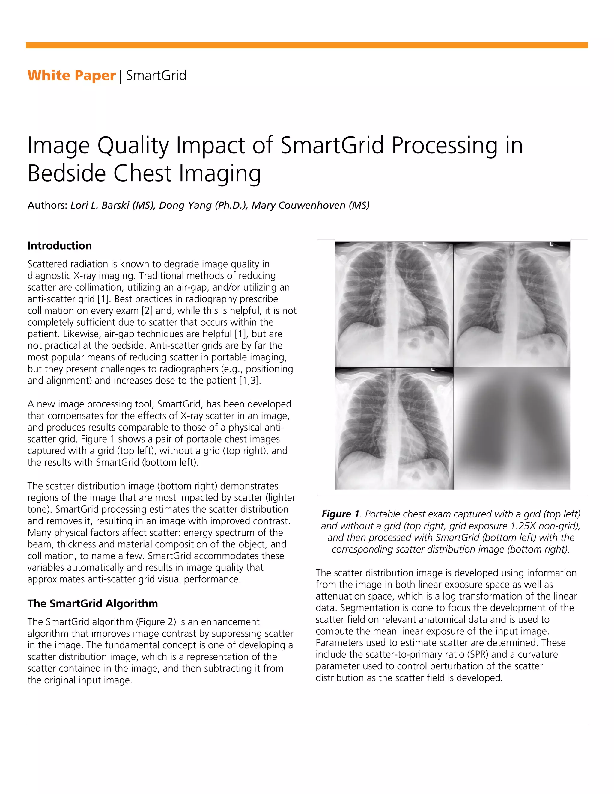 Whitepaper: Image Quality Impact of SmartGrid Processing in Bedside ...