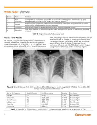 Whitepaper: Image Quality Impact of SmartGrid Processing in Bedside ...