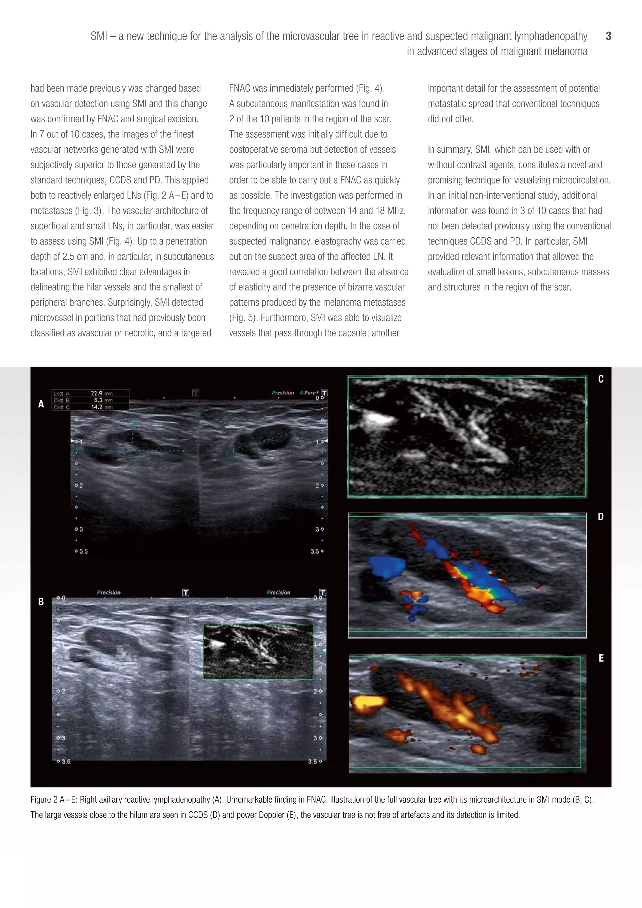 White paper "SMI – a new technique for the analysis of the ...