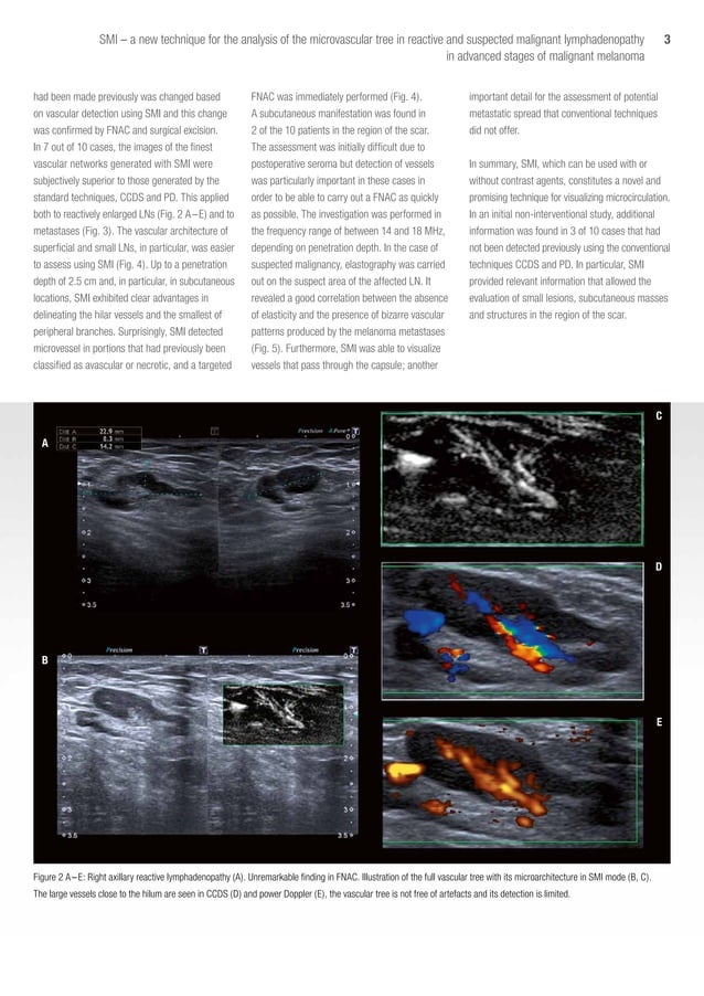 White paper "SMI – a new technique for the analysis of the ...