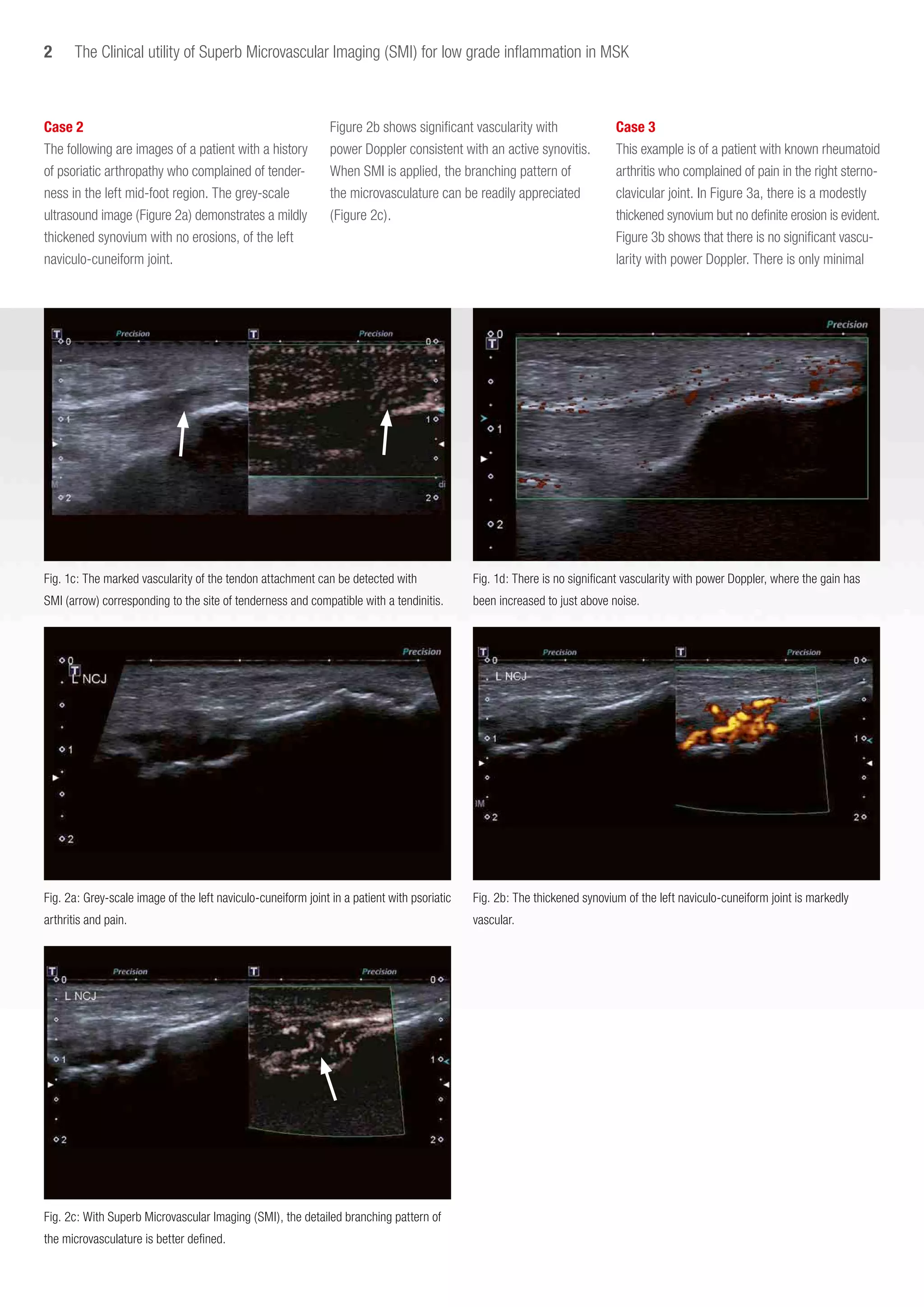 White paper "the clinical utility of smi" | PDF