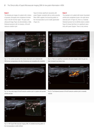 White paper "the clinical utility of smi" | PDF