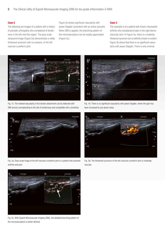 White paper "the clinical utility of smi" | PDF