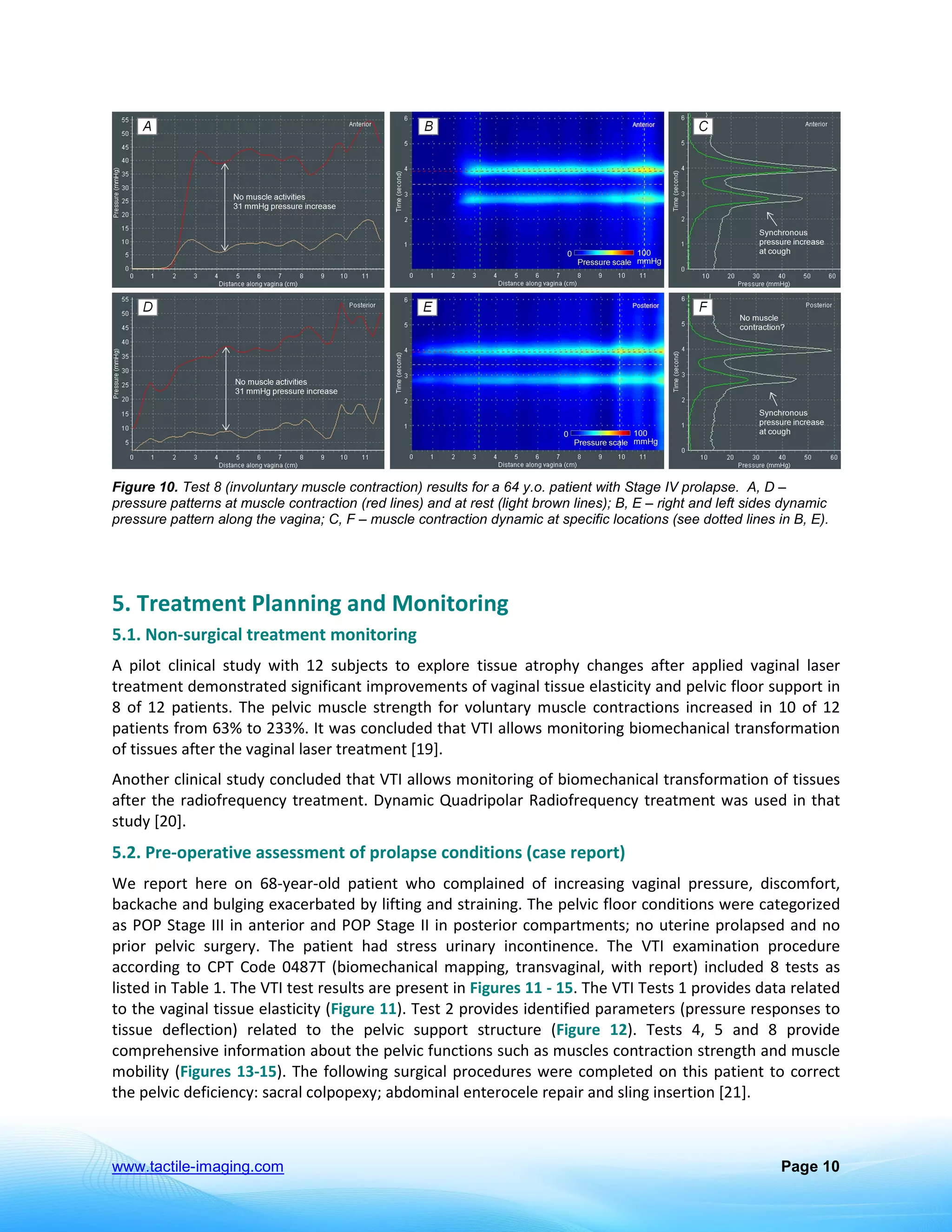 Biomechanical Mapping in Pelvic Organ Prolapse Management | PDF