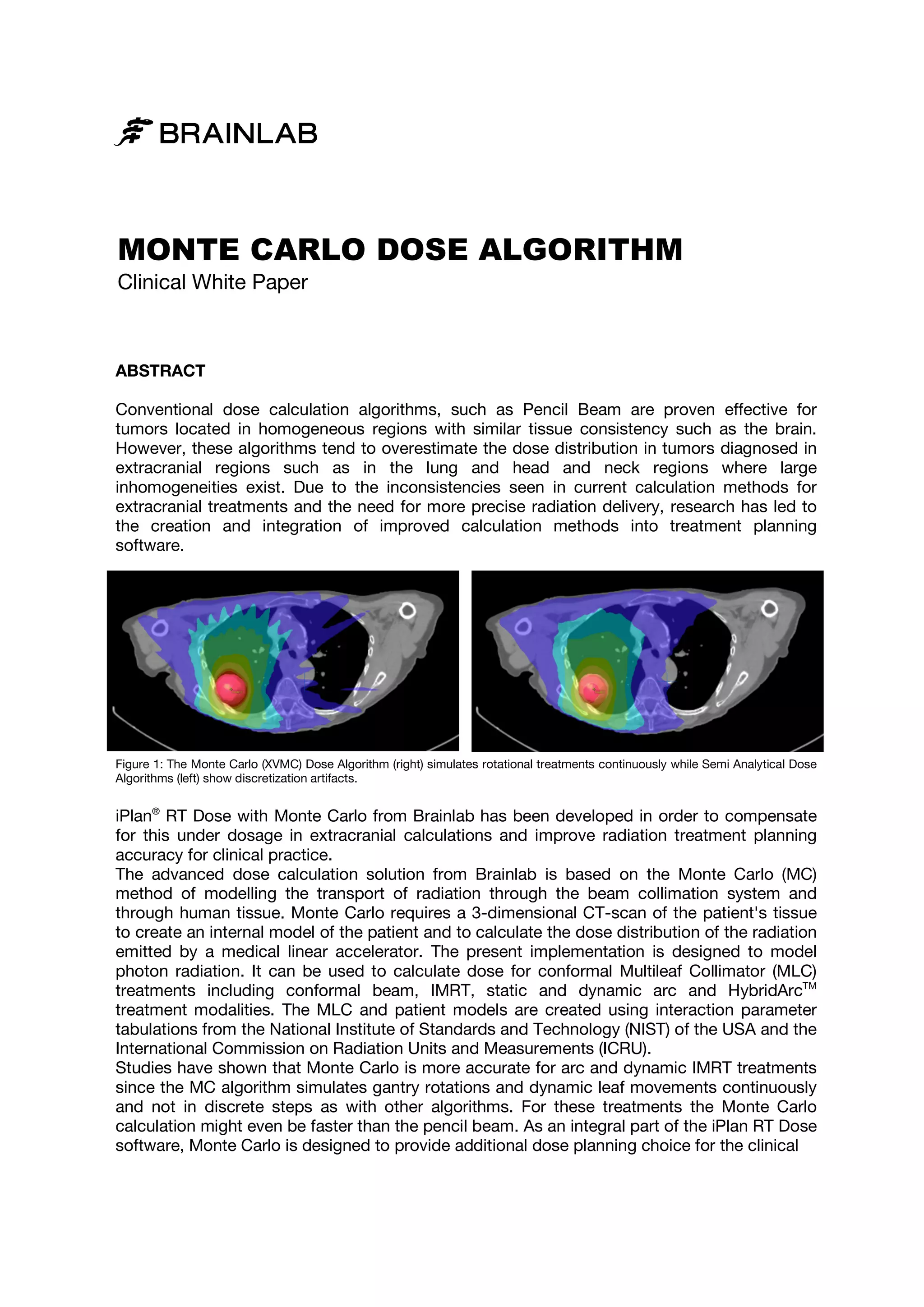 Monte Carlo Dose Algorithm Clinical White Paper | PDF